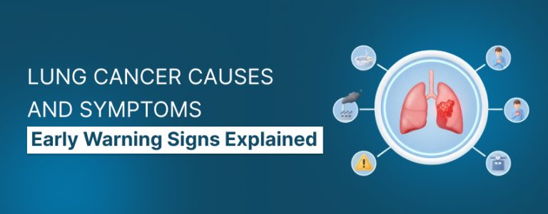 Lung Cancer Causes and Symptoms: Early Warning Signs Explained