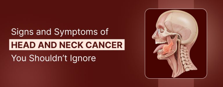 Early Signs of Throat Cancer | Symptoms You Shouldn’t Ignore