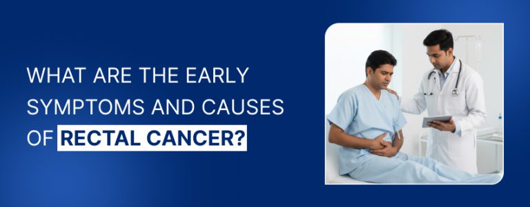Rectal Cancer Symptoms and Causes | Early Warning Signs